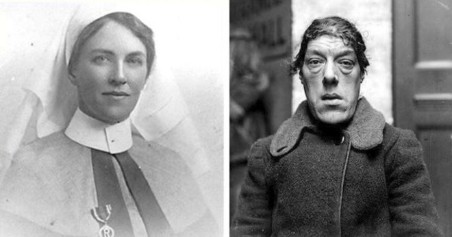 Mary Ann Bevan, a világ legcsúnyább nője