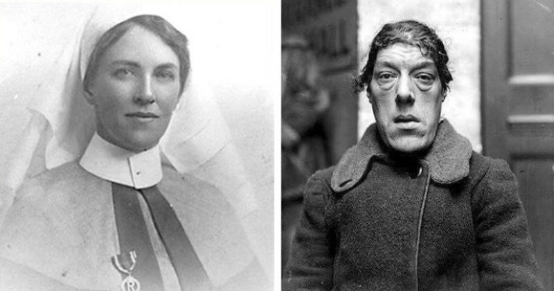 Mary Ann Bevan, a világ legcsúnyább nője